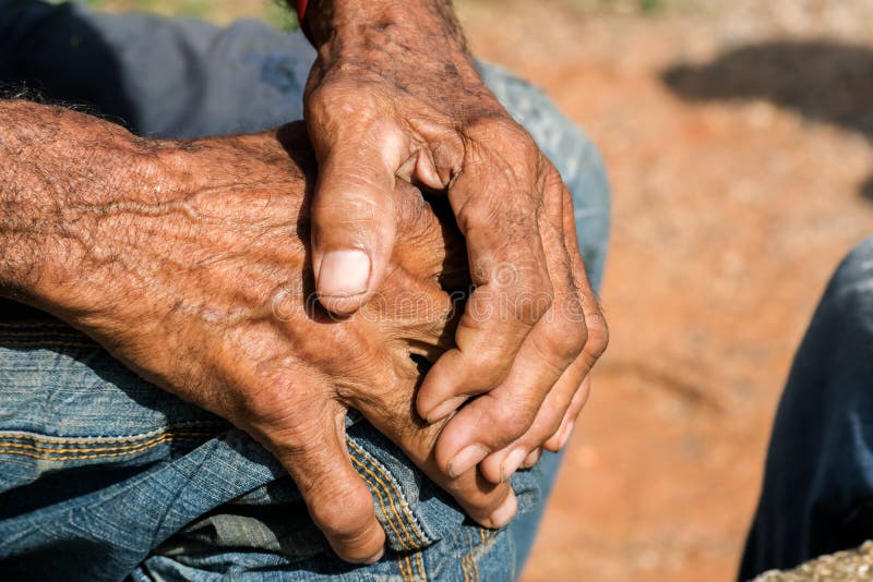 Elderly Callous Hands of a Latin Man Resting One upon the Other Stock ...