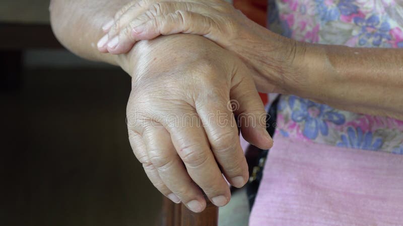 Elderly Swollen Hand or Edema Hand Syndrome Stock Footage - Video of ...
