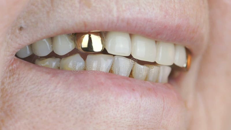 Mouth of Elderly Woman with False Teeth Stock Video - Video of mouth ...