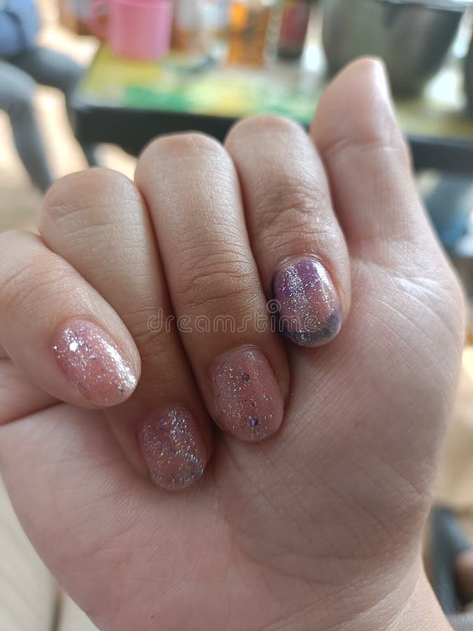 2022 Elections in the Philippines Indelible Ink on Nails Stock Image ...