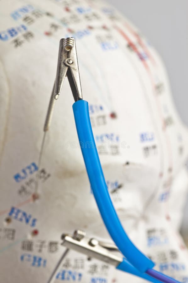 Electro Acupuncture stock image. Image of medical, natural - 21807631