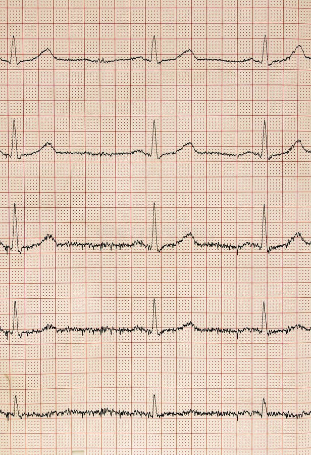 Electro-encephalogramme stock illustration. Illustration of electricity ...