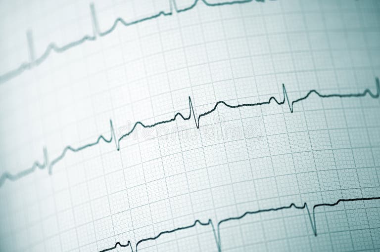 543 Electrocardiogram Blue Graph Paper Stock Photos - Free & Royalty ...