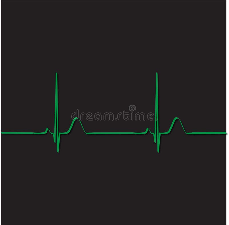 Modern Medical Technology Background. Stethoscope with Normal Pulse ...