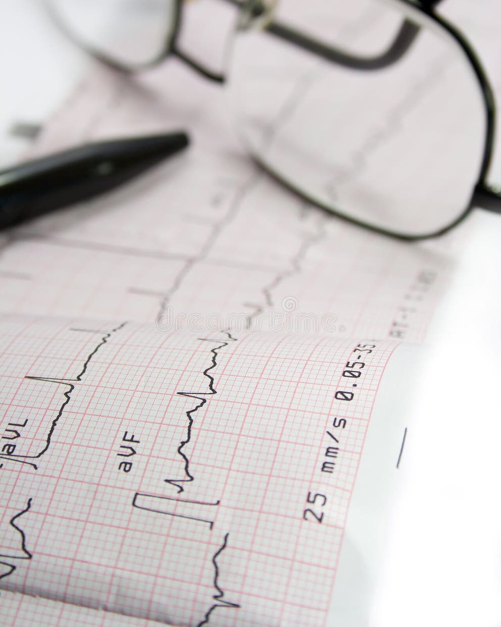 135 Blank Ecg Electrocardiogram Stock Photos - Free & Royalty-Free ...