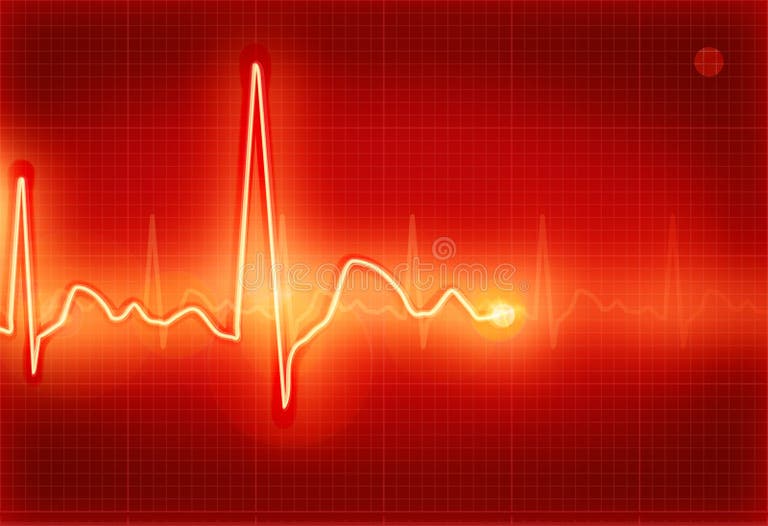 Normal Electrocardiogram Stock Illustrations – 685 Normal ...