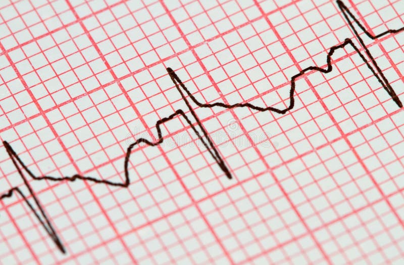 Electrocardiogram stock image. Image of cardiologist - 22317371
