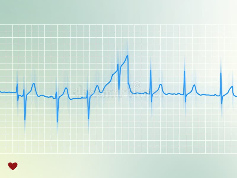 Electrocardiogram stock illustration. Illustration of lines - 5453137