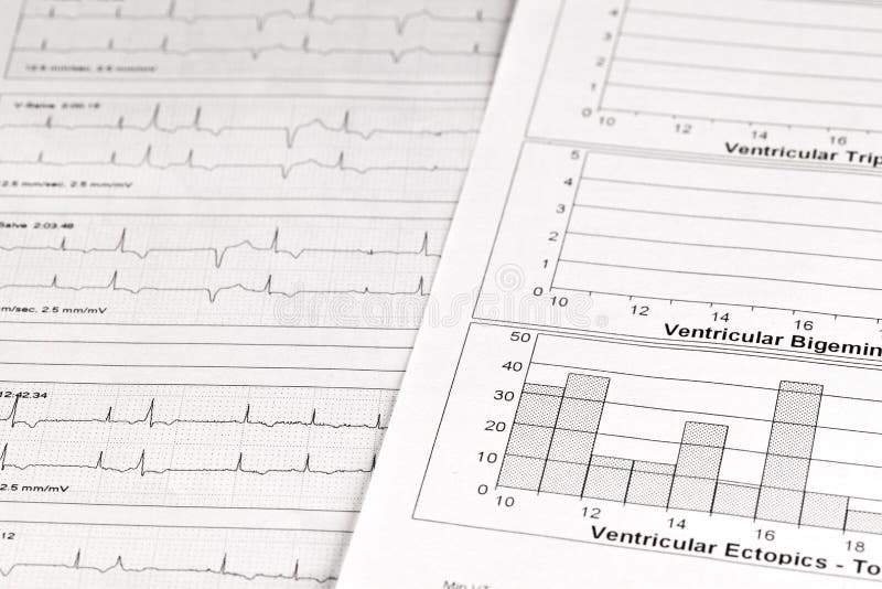 EKG chart on paper stock image. Image of horizontal - 110294321
