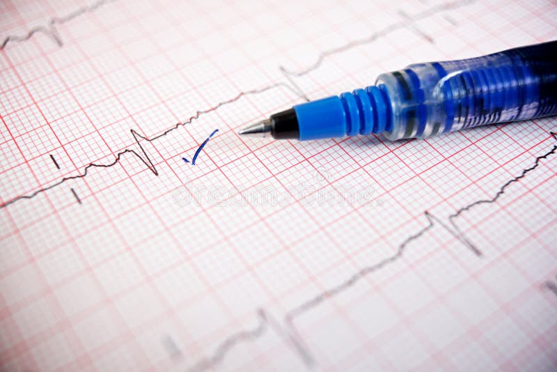 Close-up of an Electrocardiogram Printed on Blue Paper Stock Image ...
