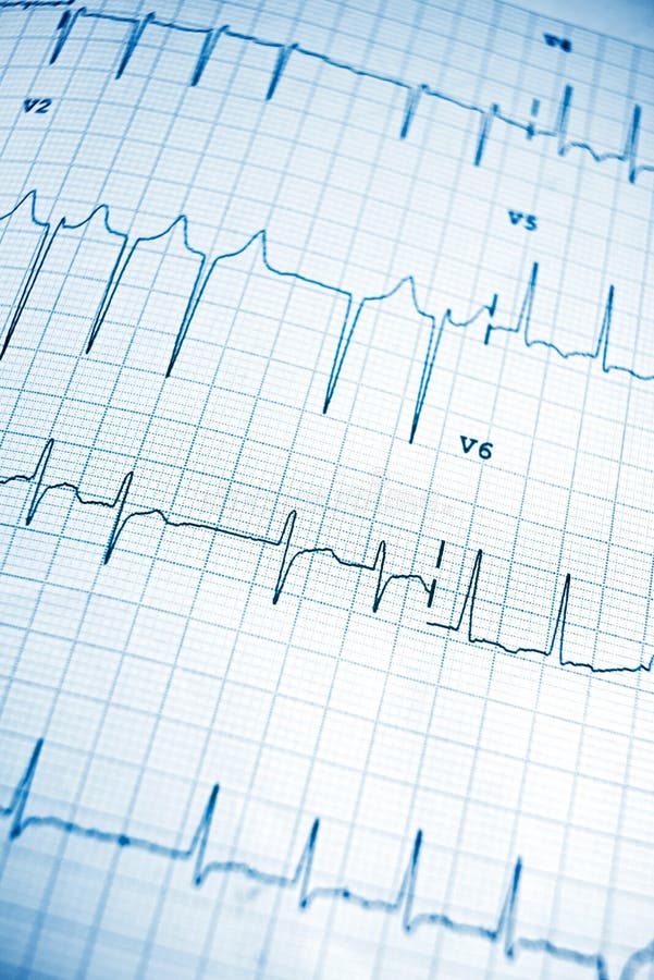 Electrocardiogram close up stock photo. Image of analysis - 149688914