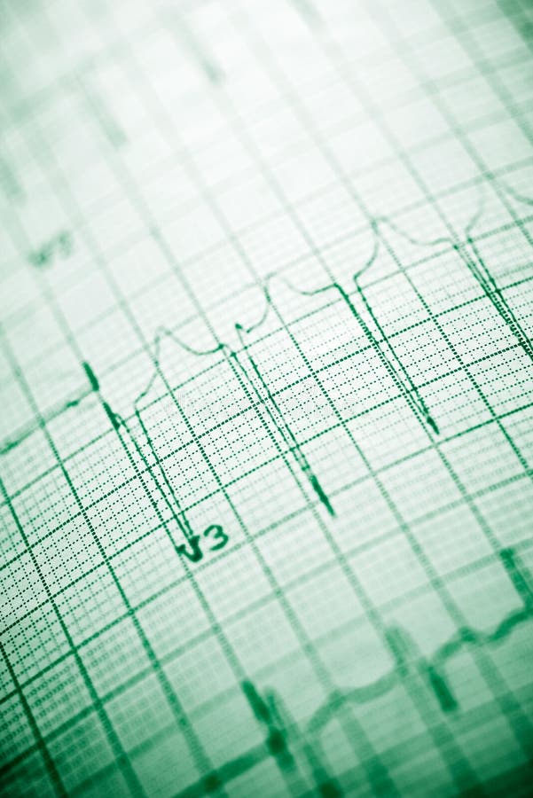 Electrocardiogram close up stock image. Image of black - 166287865