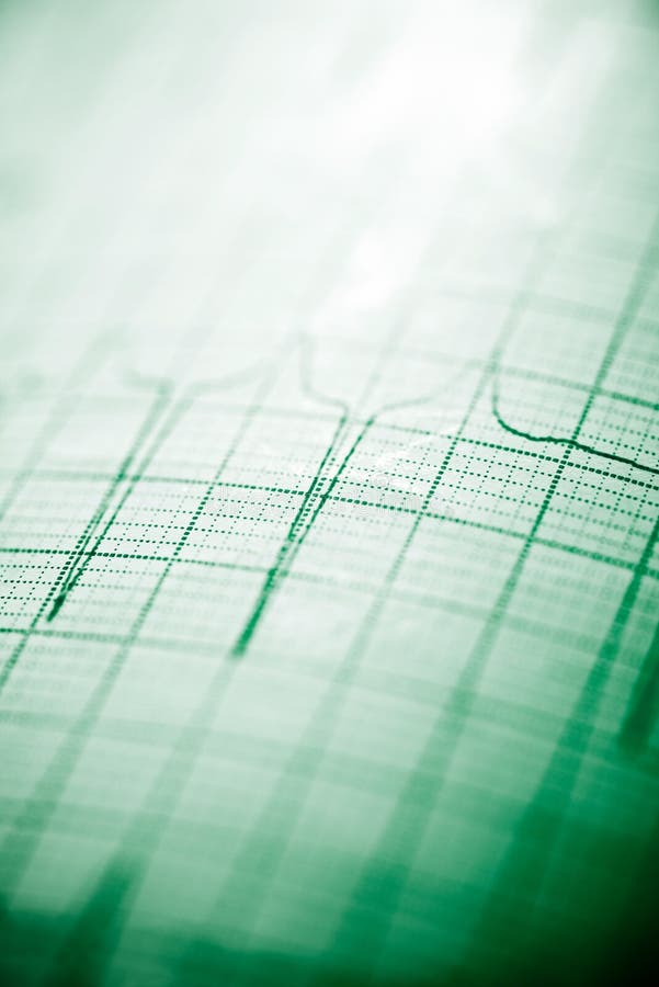 Electrocardiogram close up stock image. Image of cardiac - 166288001