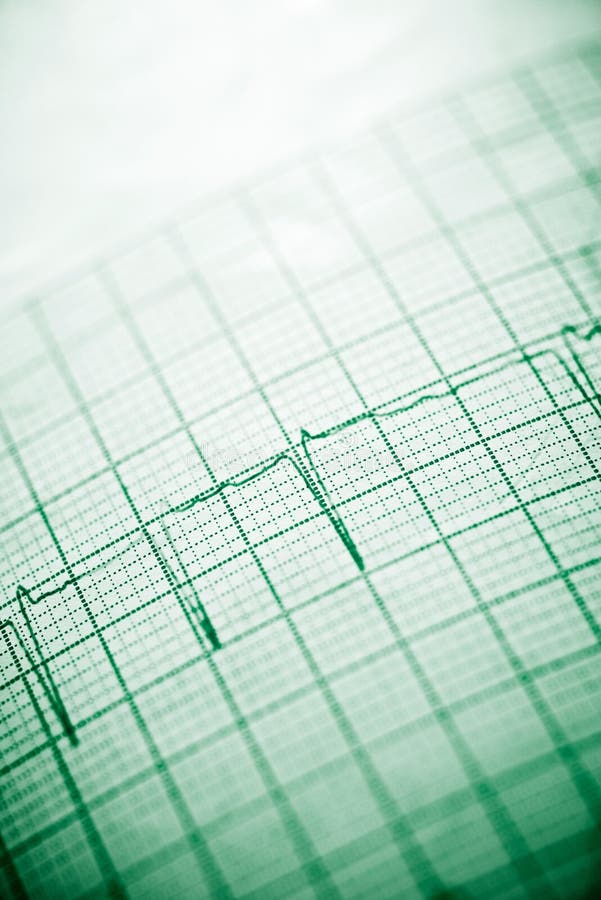 Electrocardiogram close up stock image. Image of detail - 166288021