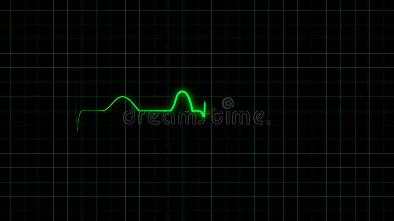 Electrocardiogram 2D Animation Stock Footage - Video of examining ...