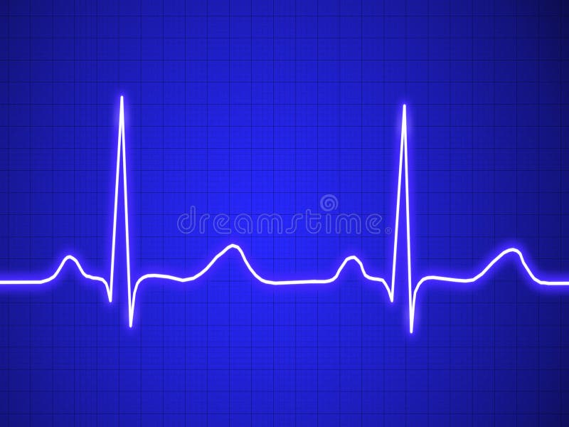 Electrocardiogram, Ecg, Graph, Pulse Tracing Stock Illustration ...