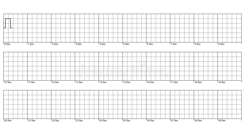 Electrocardiogram Ecg Test Print Graph on Paper Stock Illustration ...