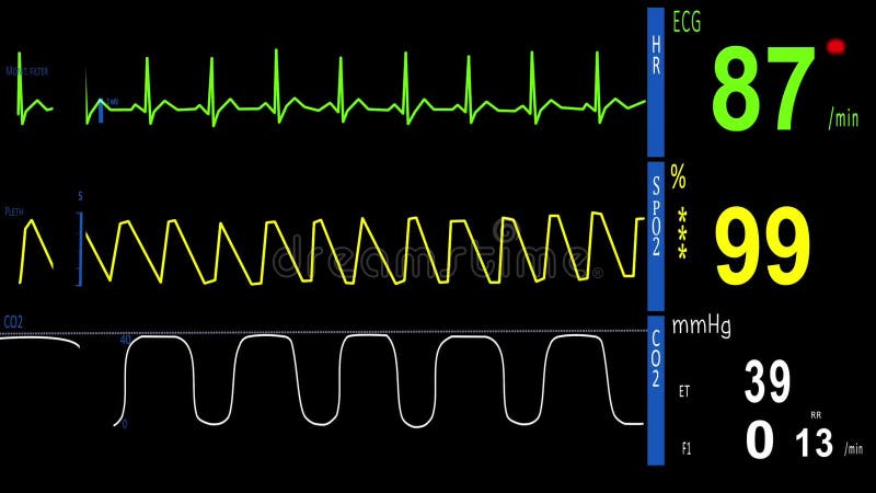 Electrocardiogram, ECG, Hartmonitor Stock Footage - Video of hartslag ...