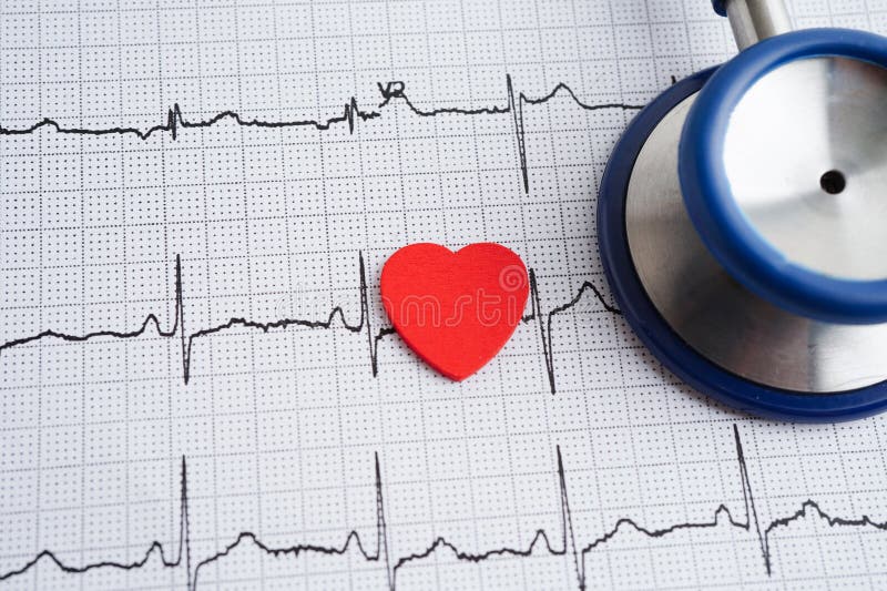 Electrocardiogram (ECG), Heart Wave, Heart Attack, Cardiogram Report ...
