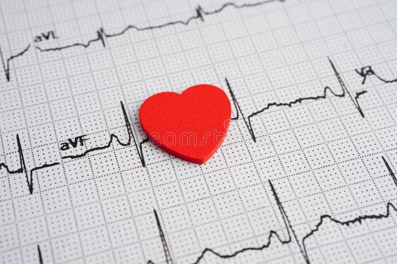 Electrocardiogram (ECG), Heart Wave, Heart Attack, Cardiogram Report ...