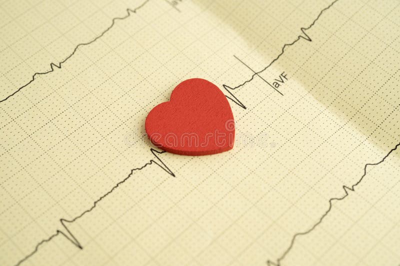 Electrocardiogram (ECG), Heart Wave, Heart Attack, Cardiogram Report ...