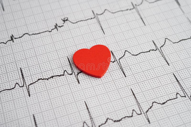 Electrocardiogram ECG, Heart Wave, Heart Attack, Cardiogram Report ...