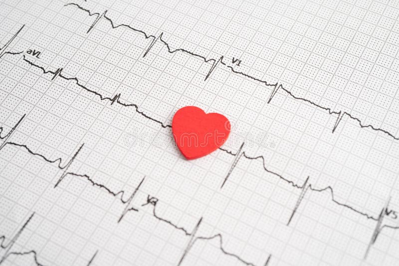 Stethoscope on Electrocardiogram ECG, Heart Wave, Heart Attack ...