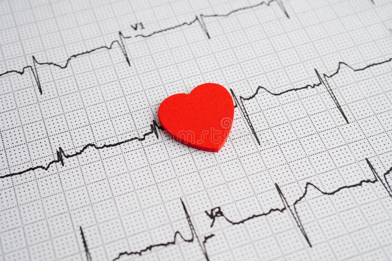Electrocardiogram (ECG), Heart Wave, Heart Attack, Cardiogram Report ...