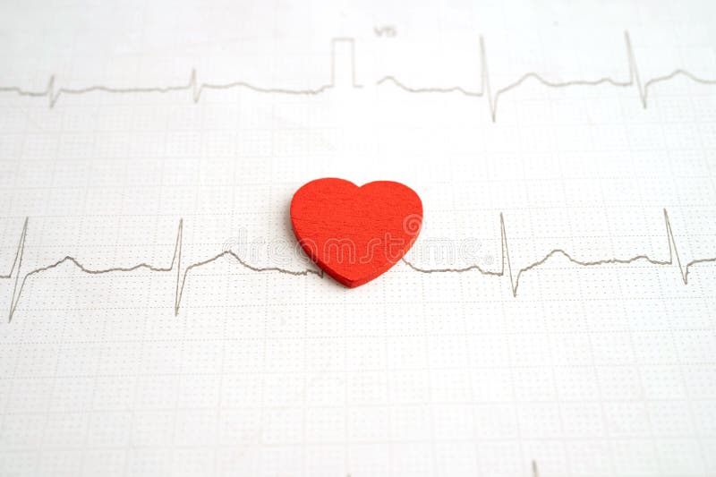 Electrocardiogram ECG, Heart Wave, Heart Attack, Cardiogram Report ...