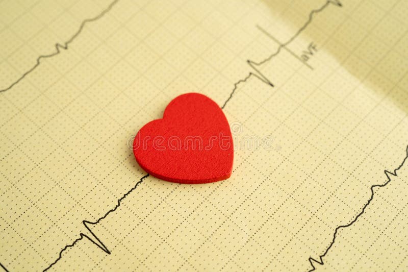 Electrocardiogram ECG, Heart Wave, Heart Attack, Cardiogram Report ...