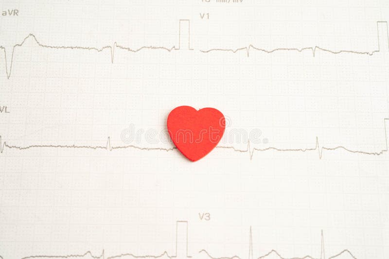 Electrocardiogram ECG, Heart Wave, Heart Attack, Cardiogram Report ...