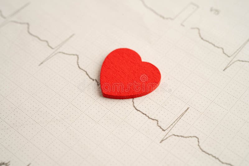 Electrocardiogram ECG, Heart Wave, Heart Attack, Cardiogram Report ...