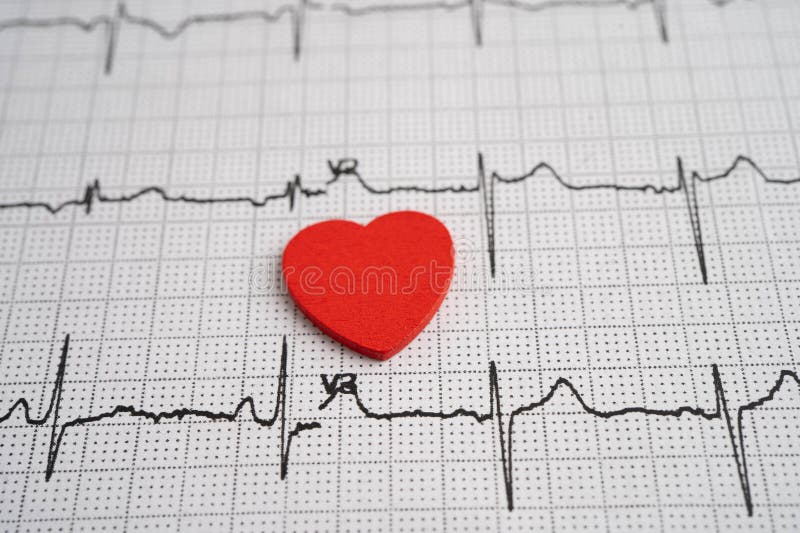 Electrocardiogram ECG Heart Wave, Heart Attack, Cardiogram Report Stock ...