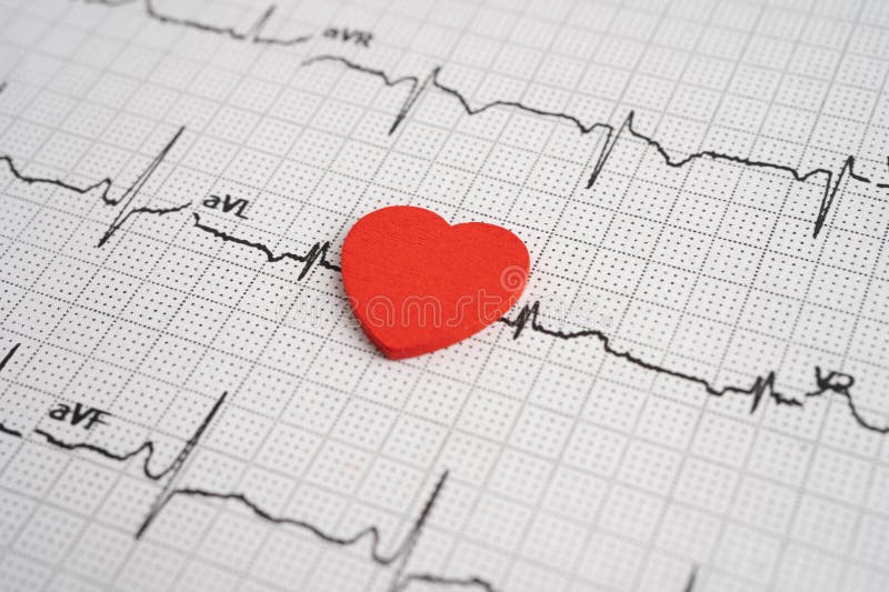 Electrocardiogram ECG Heart Wave, Heart Attack, Cardiogram Report Stock ...