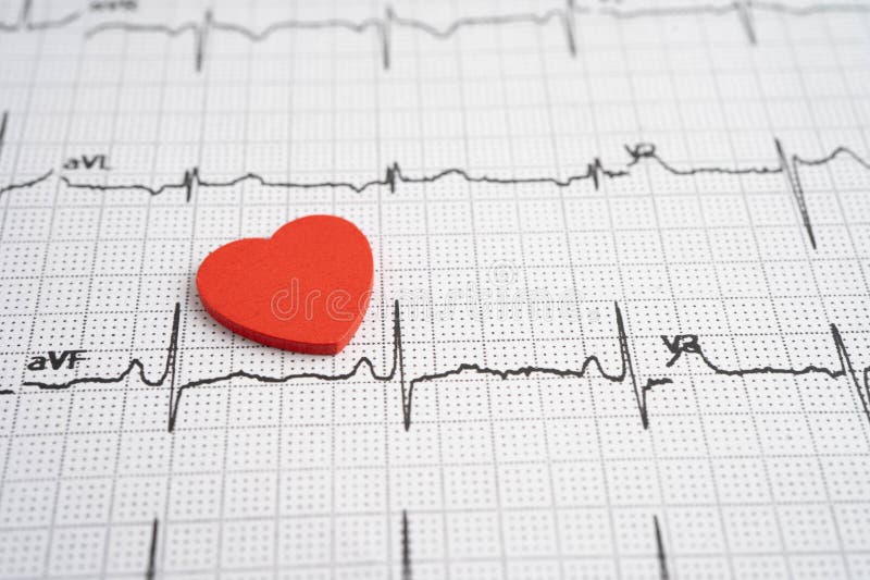 Electrocardiogram ECG Heart Wave, Heart Attack, Cardiogram Report Stock ...