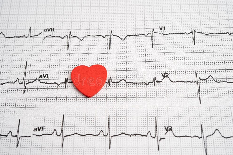 Electrocardiogram ECG Heart Wave, Heart Attack, Cardiogram Report Stock ...