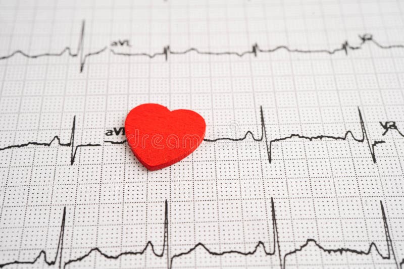 Electrocardiogram ECG Heart Wave, Heart Attack, Cardiogram Report Stock ...