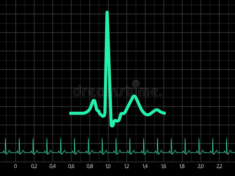 Normal Ecg Blue Background. EPS 8 Stock Vector - Illustration of blue ...