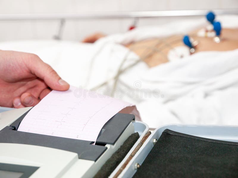 Electrocardiogram Equipment Making Cardiogram Test Stock Image - Image ...