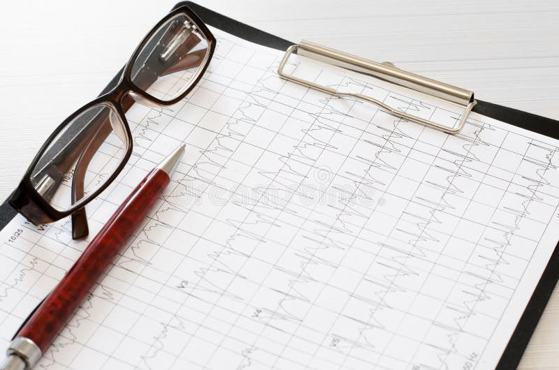 Electrocardiogram Graph, Heart Analysis. Black Clipboard Stock Photo ...