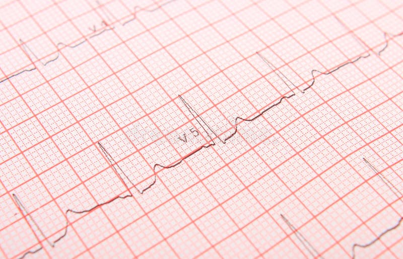 Electrocardiogram Graph Report Stock Image - Image of diagnose, heart ...