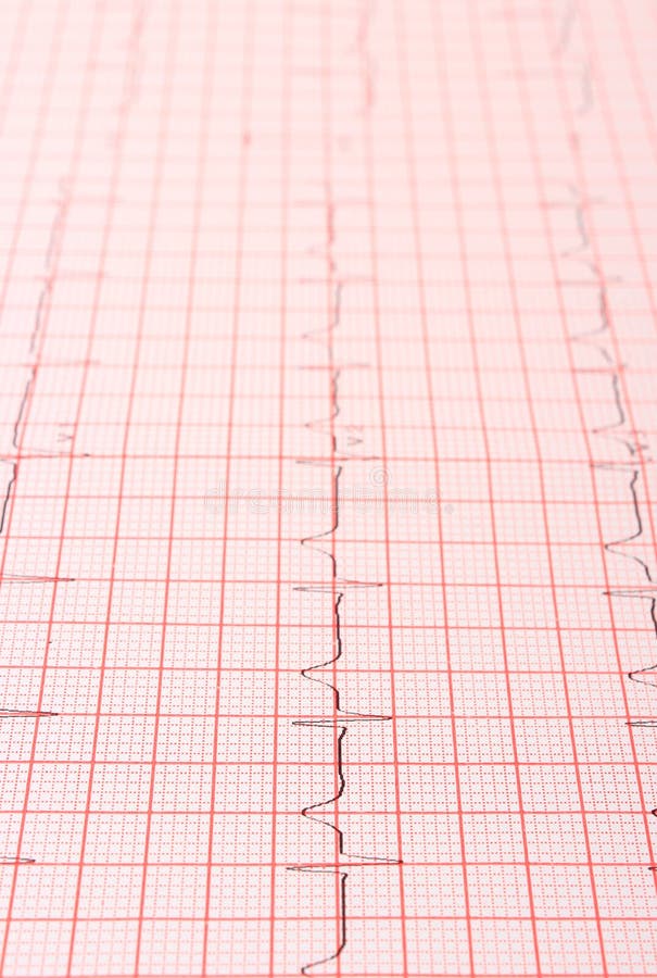 Electrocardiogram Graph Report Stock Photo - Image of cardiology, pulse ...
