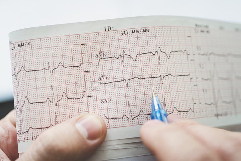 Electrocardiogram in Hands of Doctor. Heart Health Check Stock Image ...