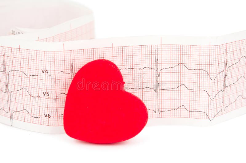 Cardiogram stock photo. Image of body, condition, heartbeat - 23746266