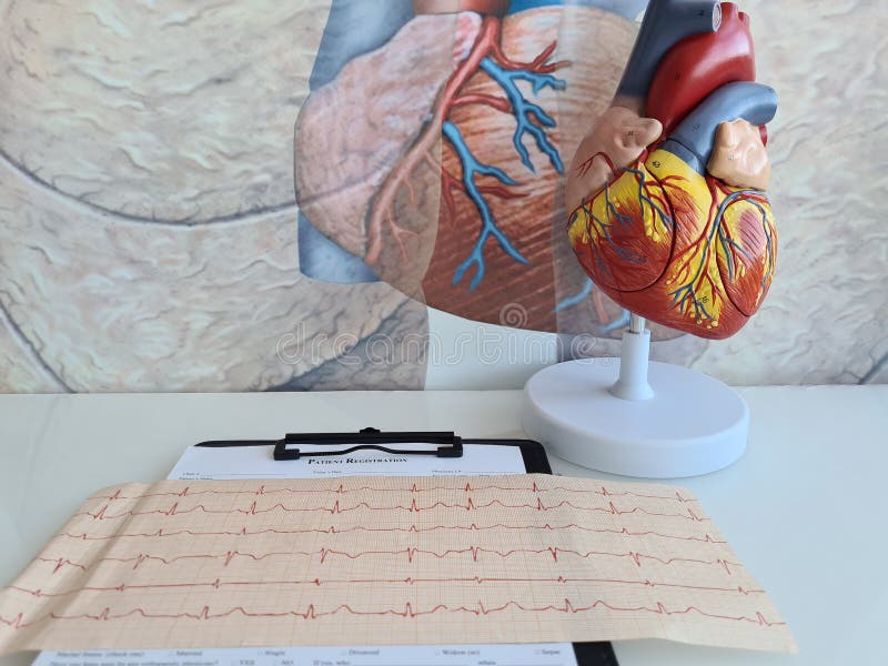 Electrocardiogram and Heart Layout. Disease of the Cardiovascular ...