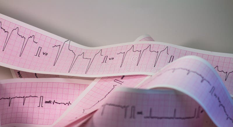 Electrocardiogram with Heartbeat. Graph Paper for Recording. Stock ...