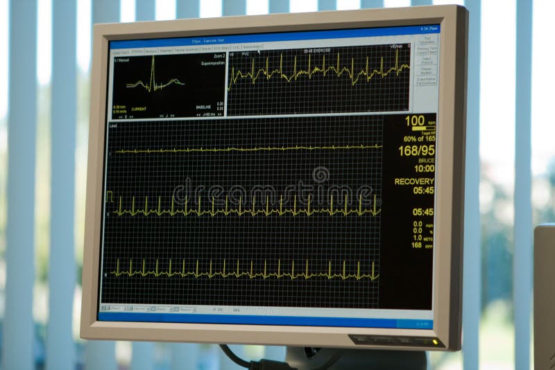 Electrocardiogram monitor stock image. Image of monitor - 18744481