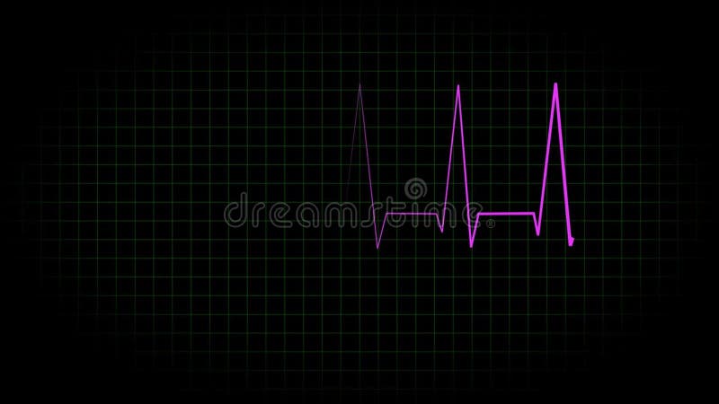 Electrocardiogram Oscilloscope Waveform Animation Motion Graphics Stock ...