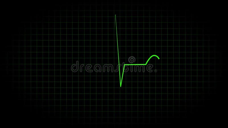 Electrocardiogram Oscilloscope Waveform Animation Motion Graphics Stock ...