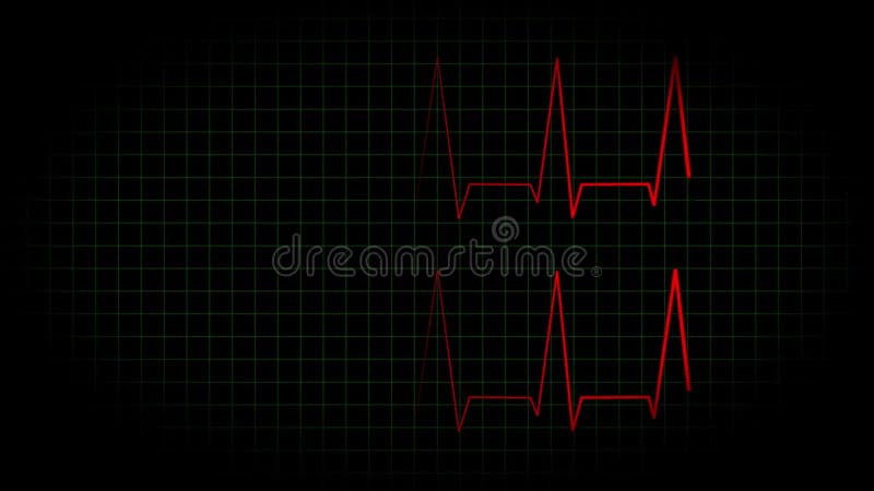 Electrocardiogram Oscilloscope Waveform Animation Motion Graphics Stock ...